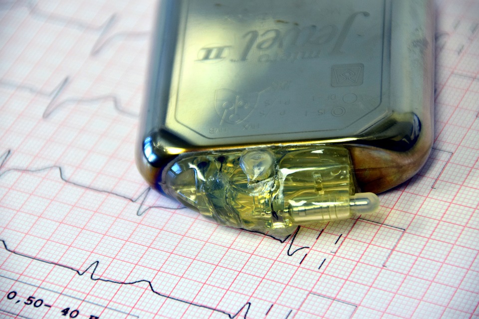 Tricky ticker: Pacemaker data ruled admissible in criminal trial ...