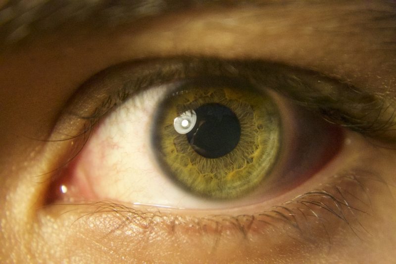 Google's Verily applies machine learning to retinal scans to predict ...