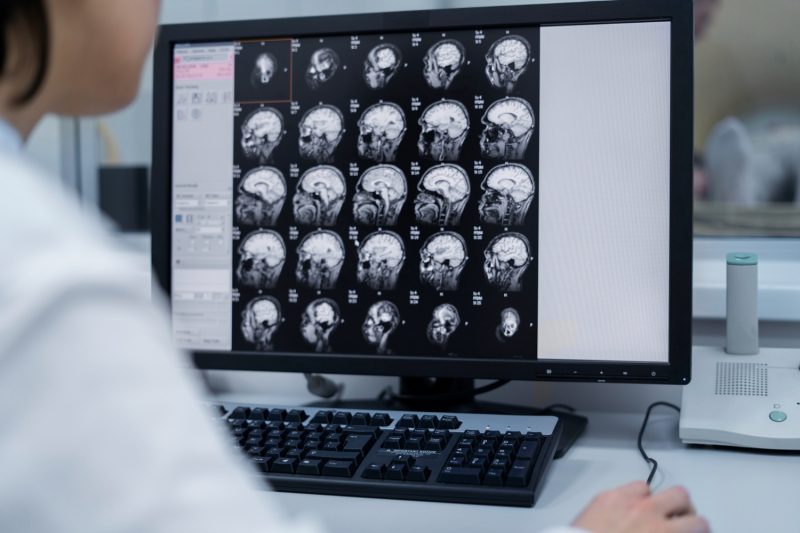 Google Cloud's Medical Imaging Suite to make AI-based diagnosis more ...